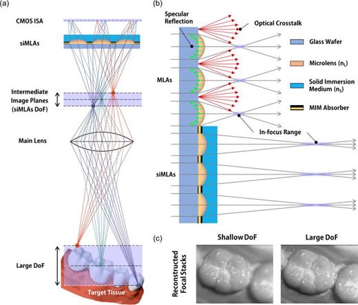 Deep focus light-field camera for handheld 3D intraoral scanning using crosstalk-free solid ...