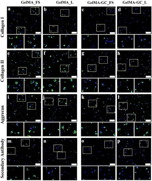 GelMA-glycol chitosan hydrogels for cartilage regeneration: The role of ...