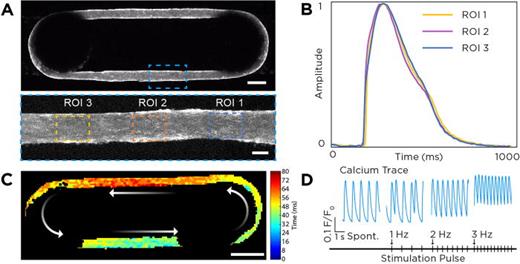 FRESH™ 3D bioprinted cardiac tissue, a bioengineered platform for in ...