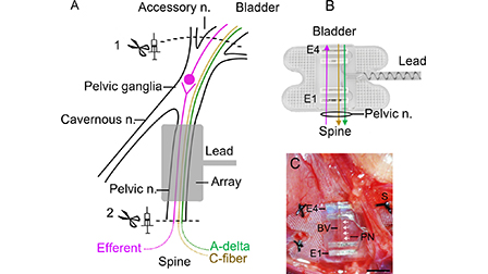 Selective recording of physiologically evoked neural activity in a ...