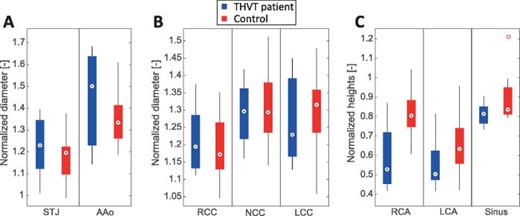Altered blood flow due to larger aortic diameters in patients with ...