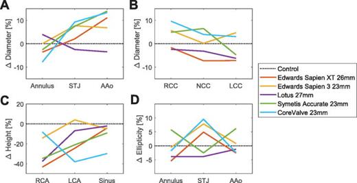 Altered blood flow due to larger aortic diameters in patients with ...