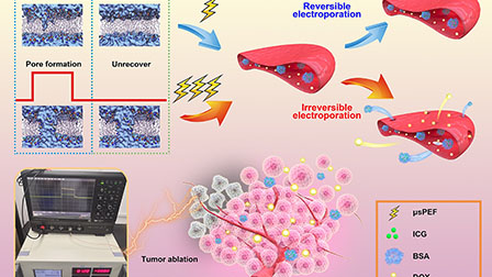 Scheduled dosage regimen by irreversible electroporation of loaded ...
