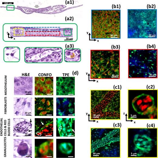 In vivo label-free tissue histology through a microstructured imaging ...