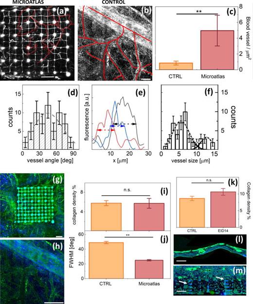 In vivo label-free tissue histology through a microstructured imaging ...