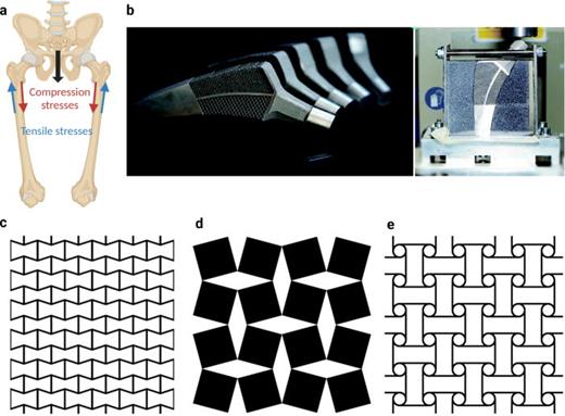 Orthopedic meta-implants | APL Bioengineering | AIP Publishing