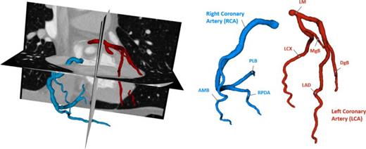 A fully automated deep learning approach for coronary artery ...