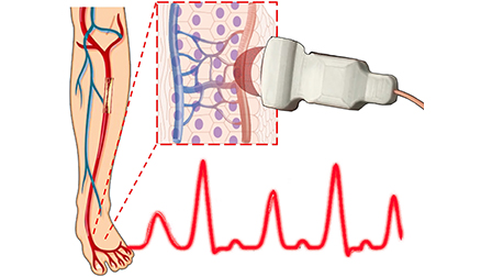 A portable optical pulsatile flowmetry demonstrates strong clinical ...