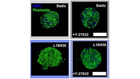 Mechanoregulation of MSC spheroid immunomodulation | APL Bioengineering ...