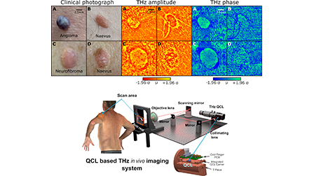 Terahertz in vivo imaging of human skin: Toward detection of abnormal ...