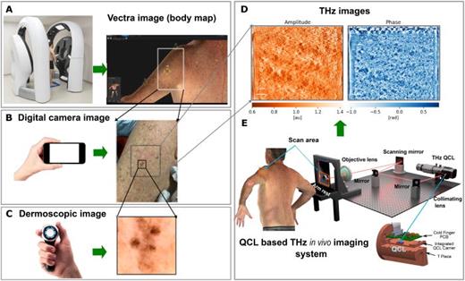 Terahertz in vivo imaging of human skin: Toward detection of abnormal ...
