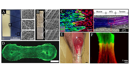 Engineering interfacial tissues: The myotendinous junction | APL ...