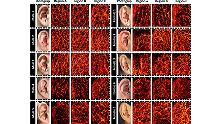 Imaging of the vascular distribution of the outer ear using optical ...