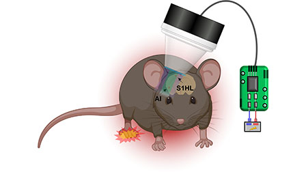 Analgesic effect of simultaneously targeting multiple pain processing ...