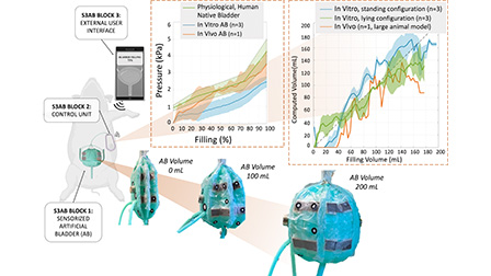 A fully implantable sensorized artificial urinary bladder to restore ...