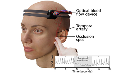 Assessing human scalp and brain blood flow sensitivities via ...