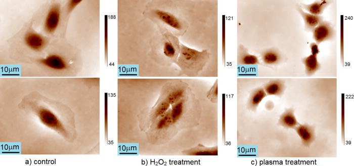 Phase imaging microscopy for the diagnostics of plasma-cell interaction ...