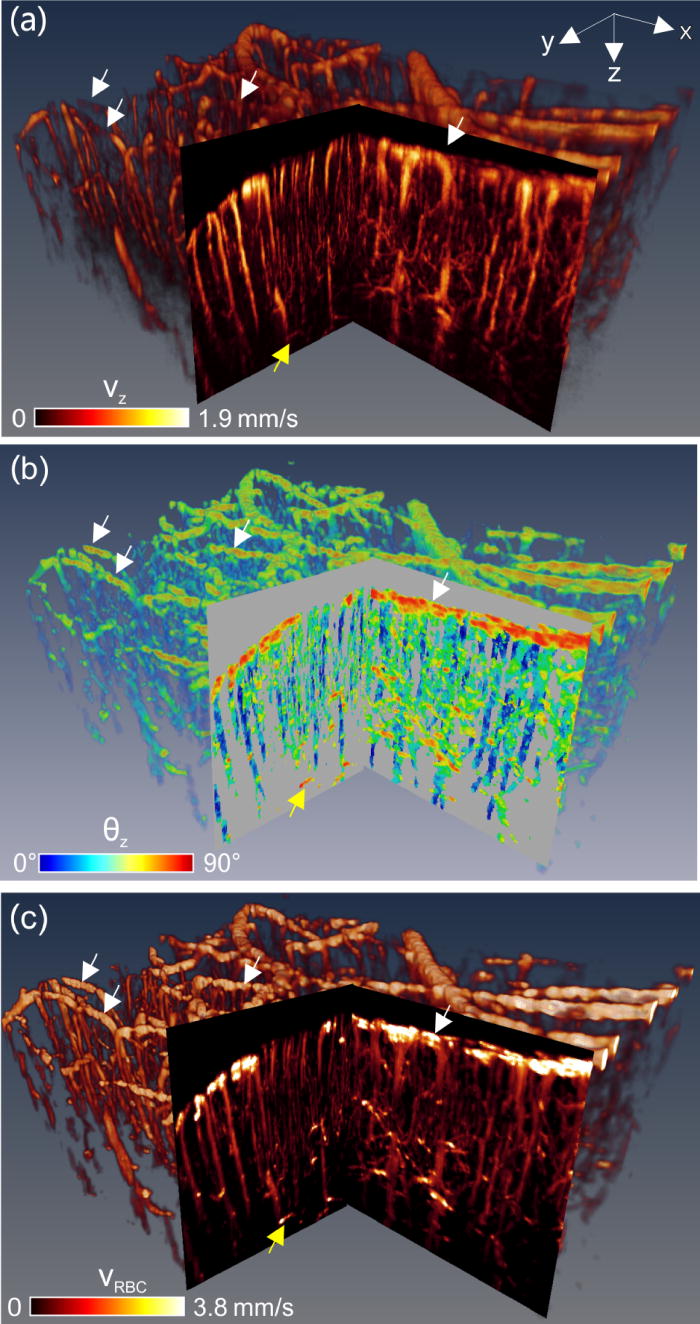 Volumetric Doppler angle correction for ultrahigh-resolution optical ...