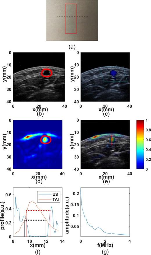 Label-free thermoacoustic imaging of human blood vessels in vivo ...