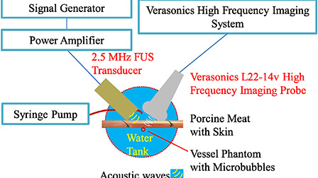 Ultrafast ultrasound imaging in acoustic microbubble trapping | Applied ...