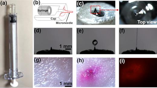 Solid and hollow metallic glass microneedles for transdermal drug ...