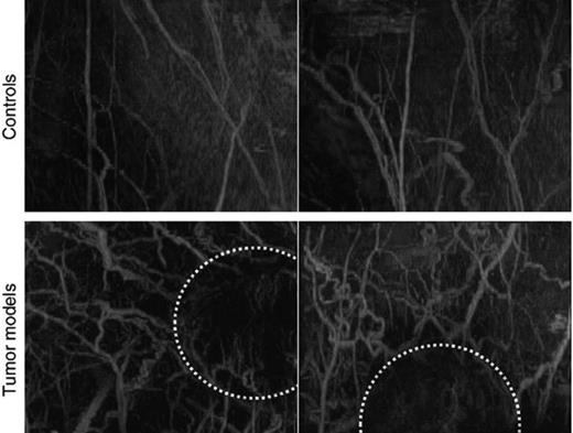 Perspectives on high resolution microvascular imaging with contrast ...
