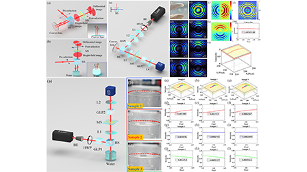 Metasurface-enhanced Newton's rings interferometer-enabled local ...