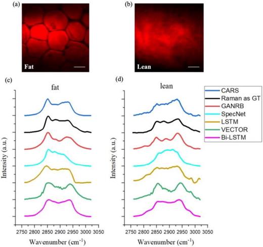 Removing non-resonant background of CARS signal with generative ...