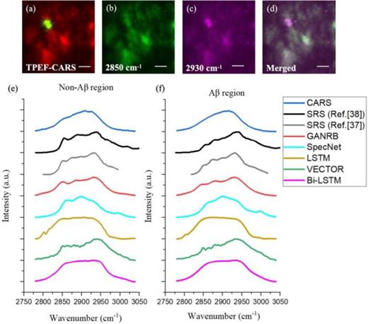 Removing non-resonant background of CARS signal with generative ...