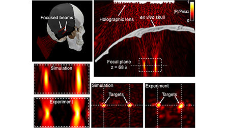 Acoustic holographic lenses for transcranial focusing in an ex vivo ...