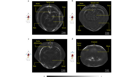 High-spatiotemporal resolution microwave-induced thermoacoustic ...