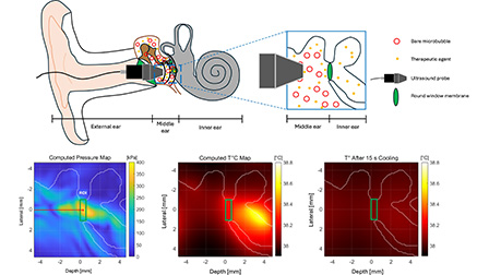 Numerical modeling of ultrasound propagation in the inner ear for ...