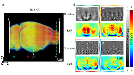 Noninvasive in vivo imaging of brain specific absorption rate using ...