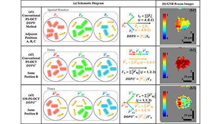 Polarization-sensitive optical coherence tomography based on speckle ...