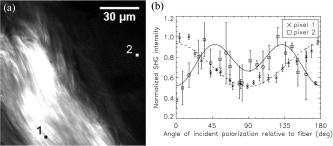Second harmonic generation χ tensor microscopy for tissue imaging ...