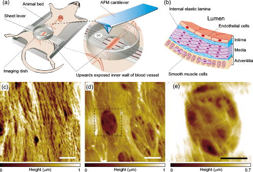 In vivo nanomechanical imaging of blood-vessel tissues directly in ...