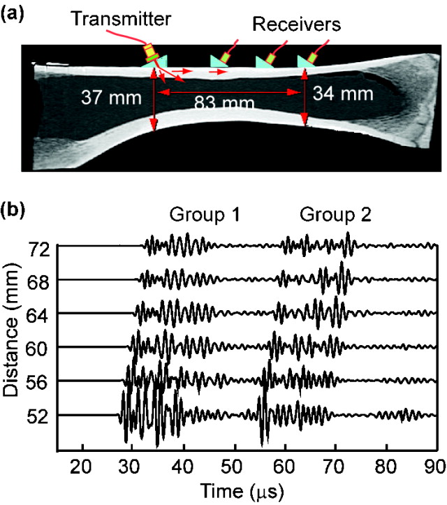 Probing long bones with ultrasonic body waves | Applied Physics Letters ...