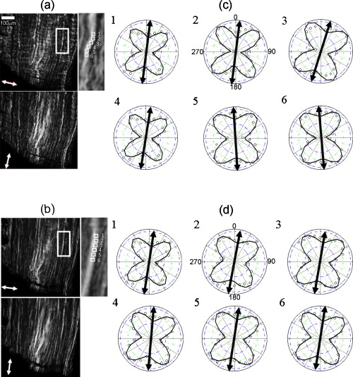 Decrimping: The first stage of collagen thermal denaturation unraveled ...