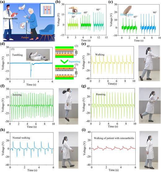A self-powered human gait monitoring sensor for osteoarthritis ...