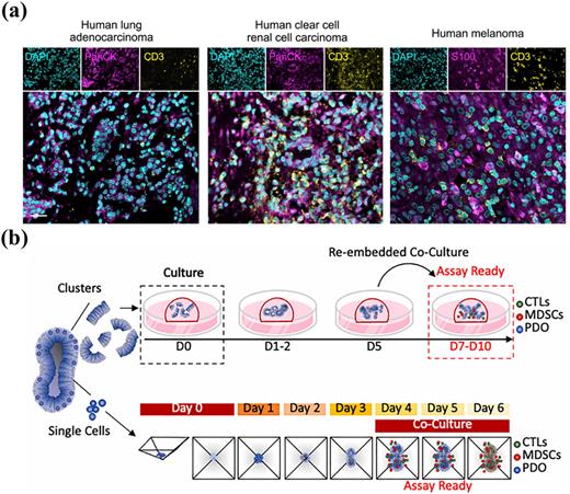 Exploring tumor organoids for cancer treatment | APL Materials | AIP ...