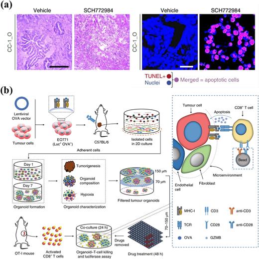 Exploring tumor organoids for cancer treatment | APL Materials | AIP ...