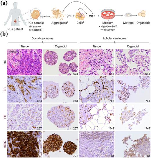 Exploring tumor organoids for cancer treatment | APL Materials | AIP ...