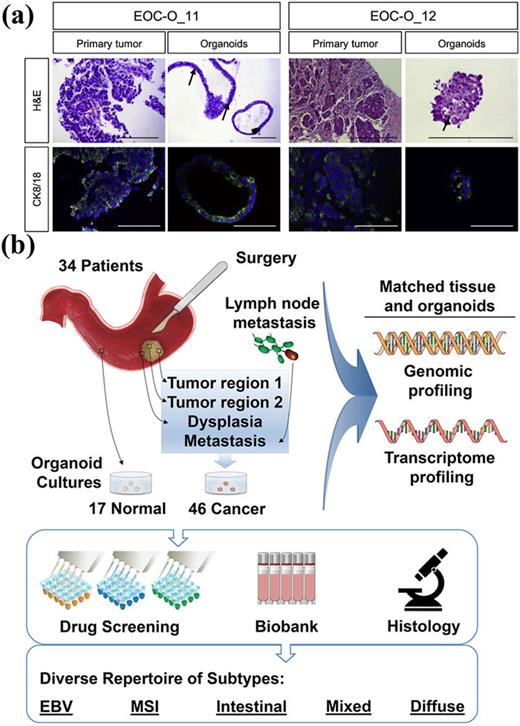 Exploring tumor organoids for cancer treatment | APL Materials | AIP ...