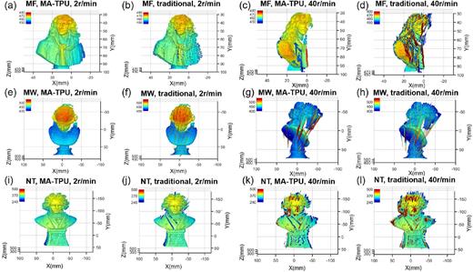 Multimodal adaptive temporal phase unwrapping using deep learning and physical priors | APL ...