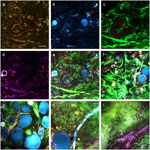 Simultaneous label-free autofluorescence-multiharmonic microscopy and ...