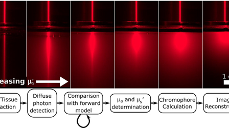 Recent advances in high speed diffuse optical imaging in biomedicine ...