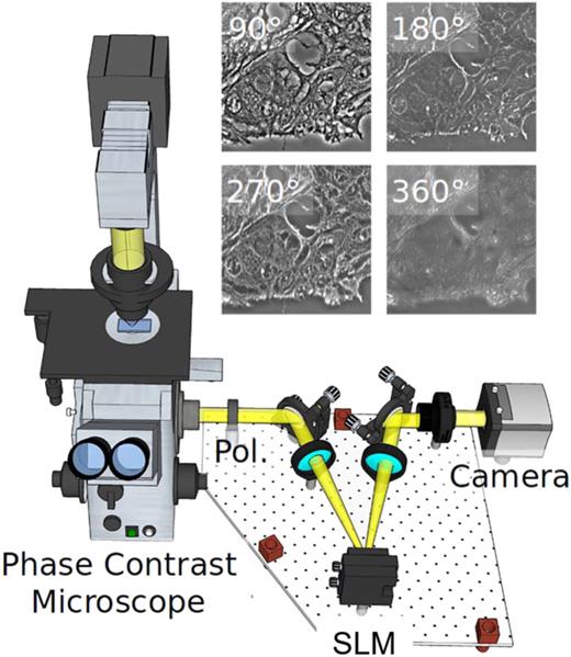 Label-free colorectal cancer screening using deep learning and spatial light interference ...