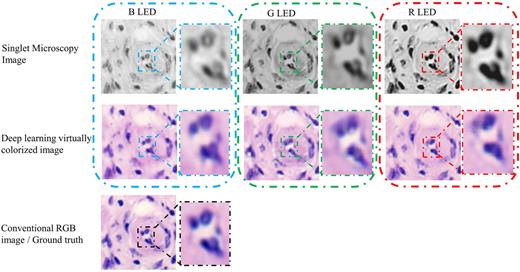 Deep learning virtual colorization overcoming chromatic aberrations in ...