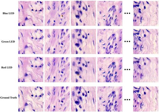 Deep learning virtual colorization overcoming chromatic aberrations in ...