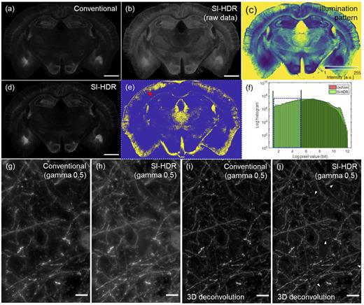 High-throughput high-dynamic range imaging by spatiotemporally ...